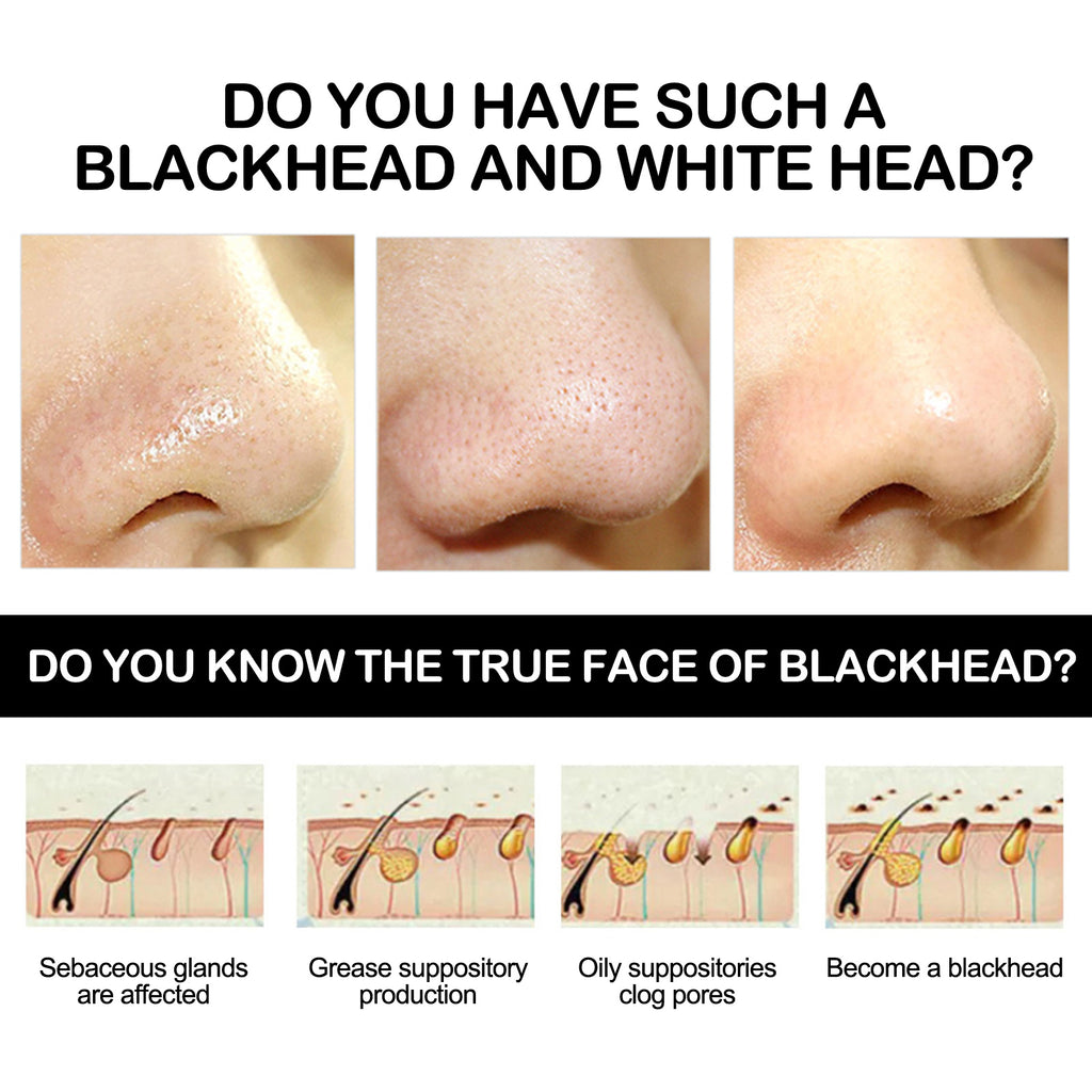 Bamboo Charcoal Cleansing Mask – Deep Pore Detox, Blackhead Removal ...